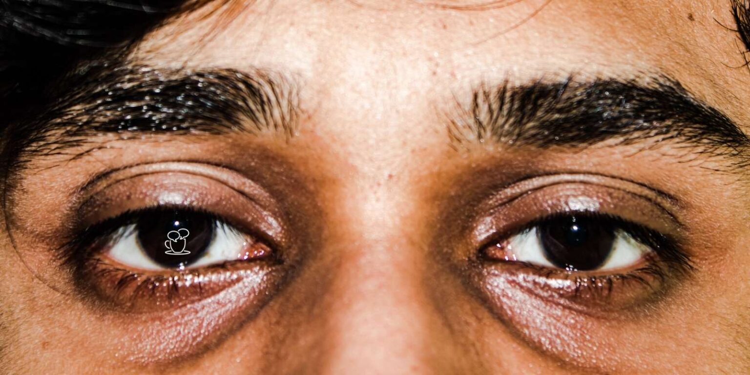 Tipos de olheiras - Prosa Com Nath Souza