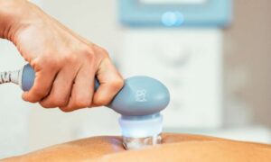 Endolifting: como funciona e quais são os seus benefícios? - Prosa Com ...