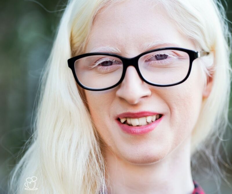 Discromias – Acromia e Hipocromia - Prosa Com Nath Souza